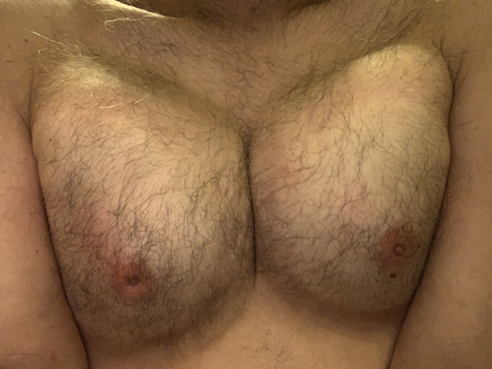 Saline Breast 9 Pics Xhamster 0980