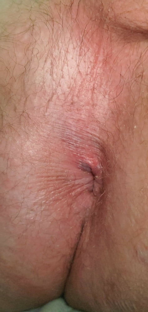 Showing Off My Body 11 Pics Xhamster