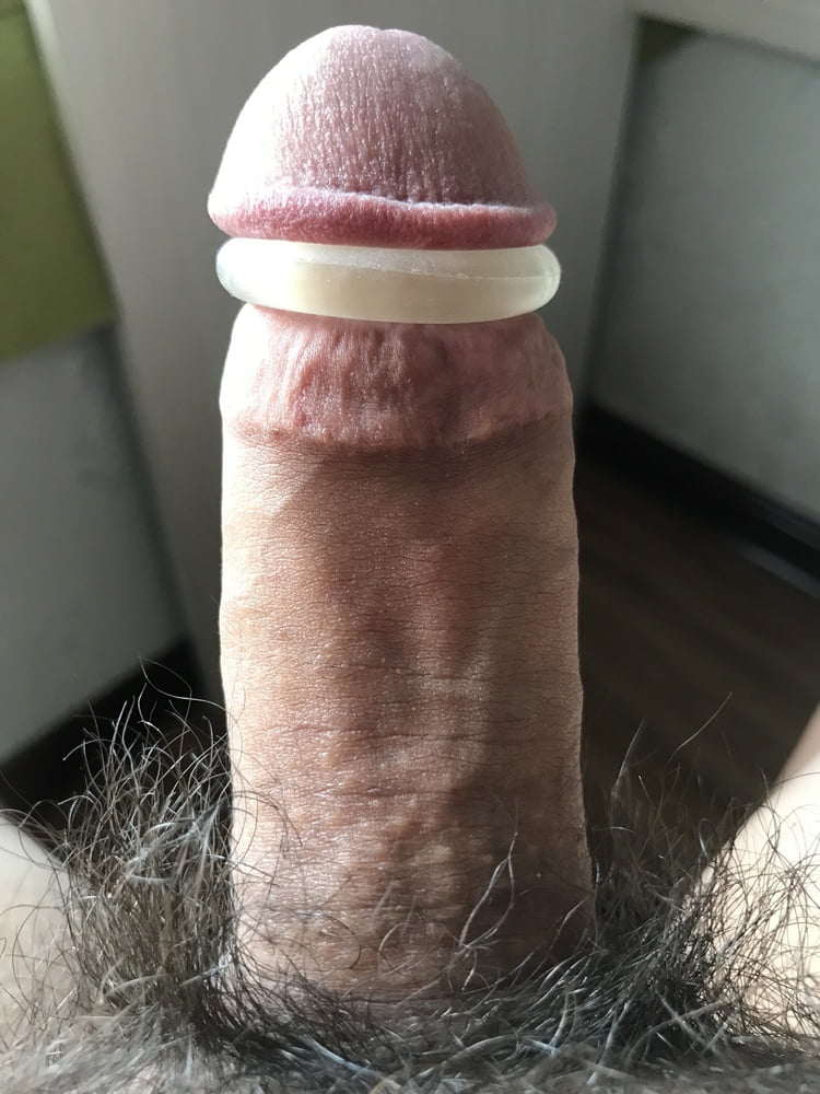 Put A Rubber Ring On The Glans 5 Pics Xhamster