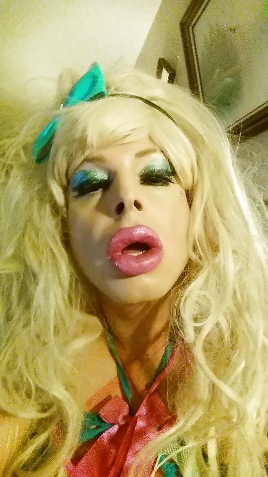My New Silicone Lips 5 Pics Xhamster